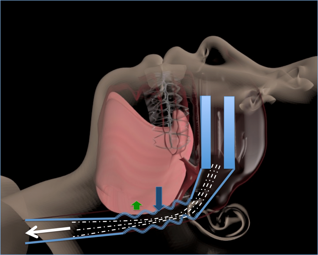 Impact de la langue sur le ronflement - Tongue Lab Academy